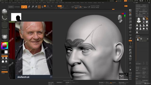 12. Cranium Structures on Anthony