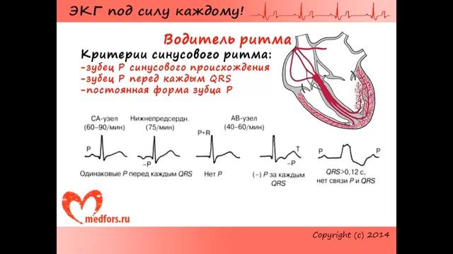 Урок 3. Видеокурс ЭКГ под силу каждому.