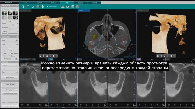 Просмотр ВНС