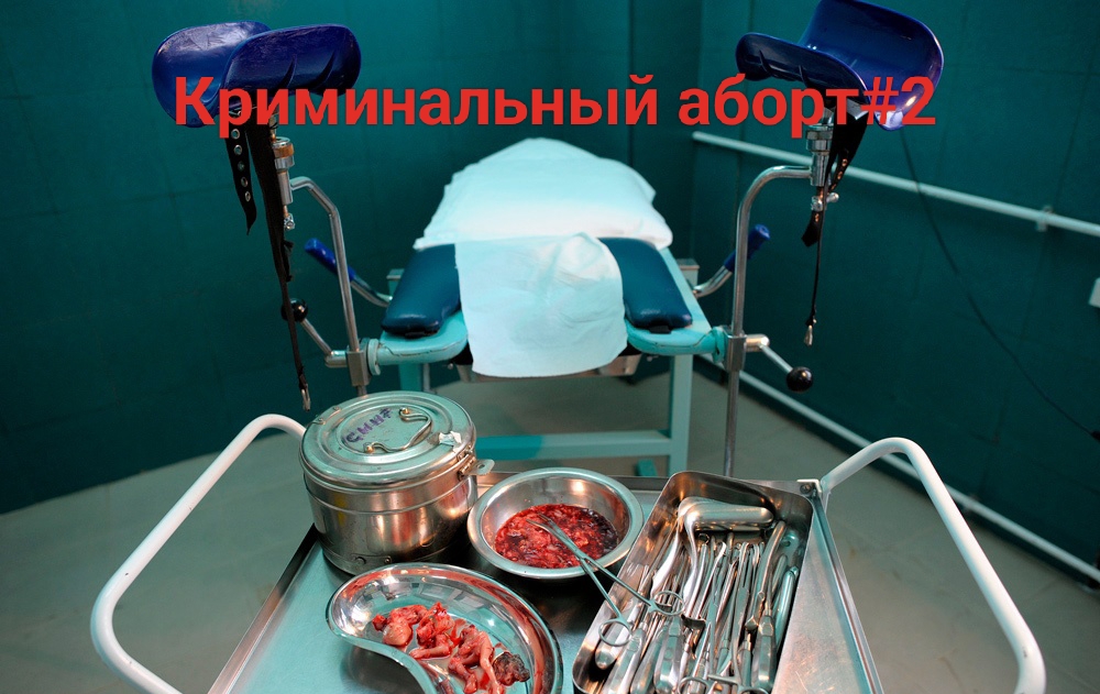 Криминальный аборт#2