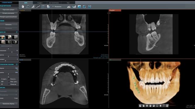 Трассировка канала НЧ