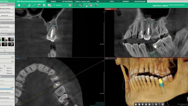 Переход между сохраненными проектами
