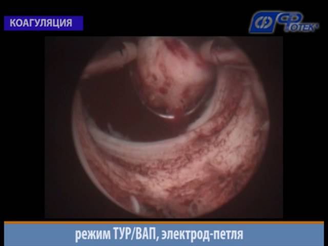 Режим ТУР/ВАП