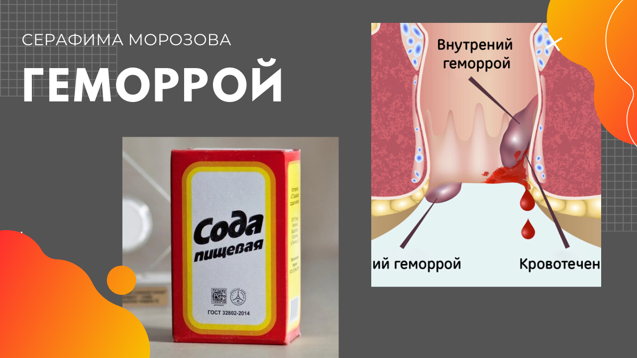 Что надо знать про геморрой.mkv