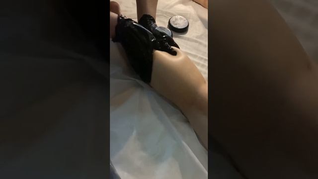 Стоун-терапия