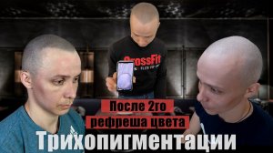 2 года с тату волос! История обновлений цвета! Трихопигментация в Москве Scalp Micropigmentation SMP