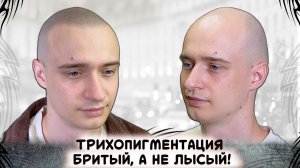 Трихопигментация в Москве. Бритый а не лысый! Лучше чем пересадка  SMP Scalp Micropigmentation.