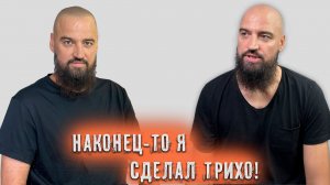 Наконец-то я сделал Трихо! Трихопигментация против облысения вместо пересадки волос Scalp tattoo SMP