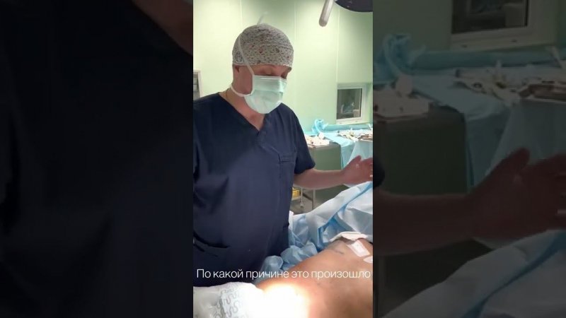 Якорная подтяжка груди с липофилингом от Волкова П. В.