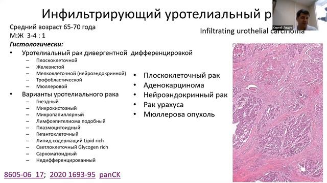 6 из 7. Грейды и инвазивный рак