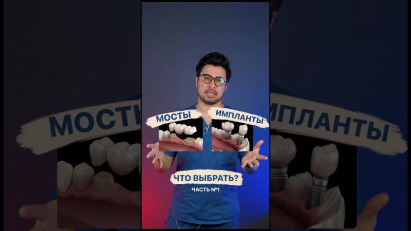 Мосты или имплантаты: что выбрать? Часть 1.